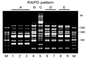 Gel documentation - geneticslab